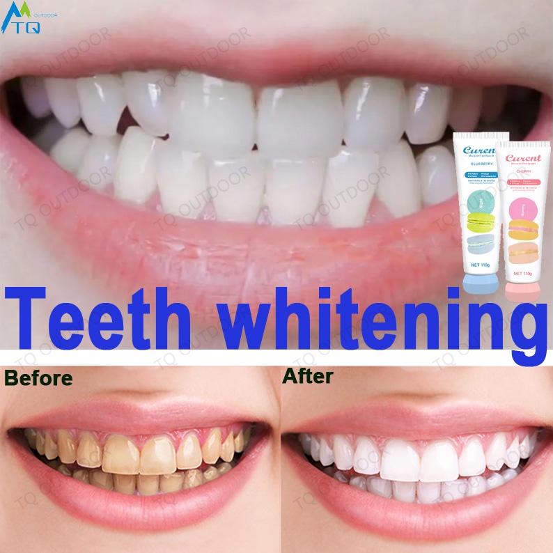 【Ready stock】 Whitening toothpaste removing yellow tartar Fresh Breath ...
