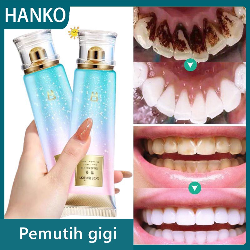 HANKO💯 ORIGINAL Whitening Toothpaste Niacinamide Remover Putihkan Gigi ...