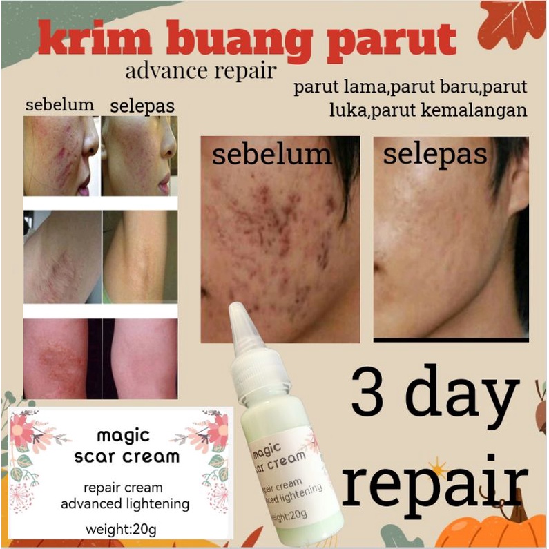 krim buang parut/hilang parut/clear parut/kulit cantik/parut jerawat ...