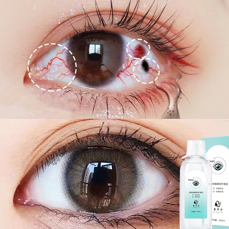 Medical Eye Wash Care Eye Washer Eye Cleaner Suitable For Bloodshot Dry ...