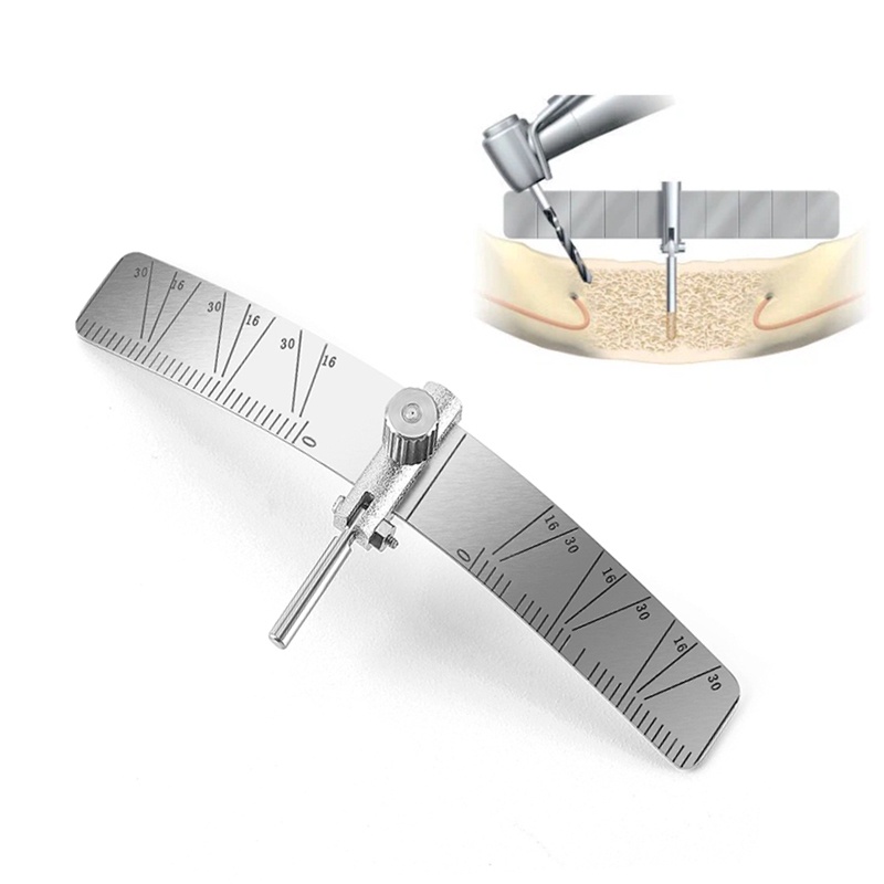 Dental Implant Locating Guide Surgical Planting Positioning Locator ...