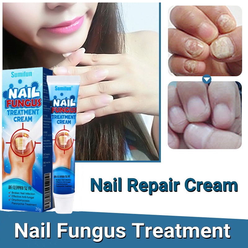 Ubat Kuku Nail Repair Cream Krim Kuku Ubat Sapu Rawat kuku Rosak Nail ...