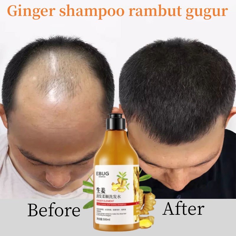 shampoo rambut gugur Ginger shampoo hair fall shampoo Hair Loss ...