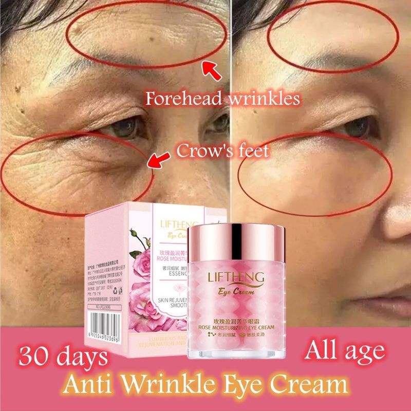 CREAM MATA MENGATASI KANTONG MATA | Shopee Malaysia