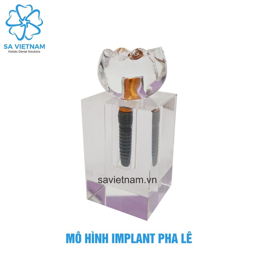 Crystal Implant Model | Shopee Malaysia