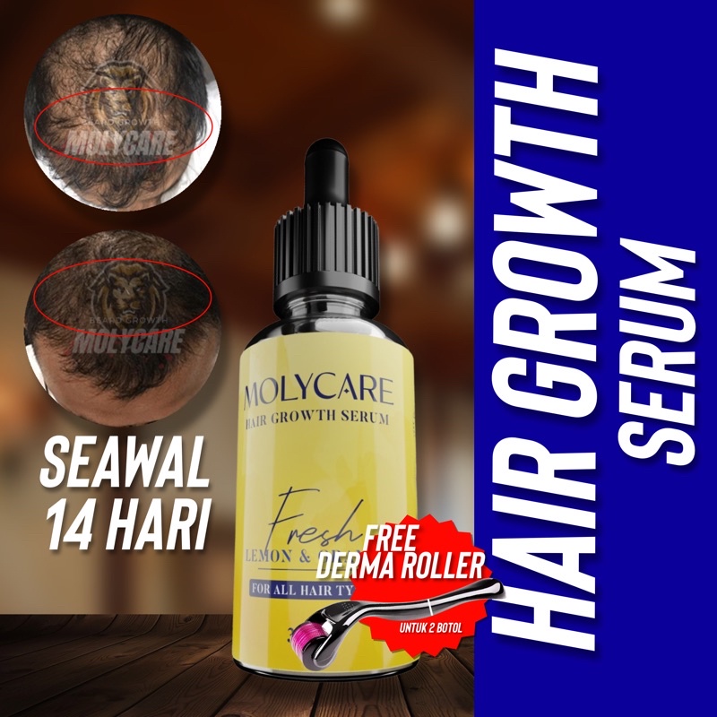 Molycare Hair Growth Serum - Pelebat Rambut Dan Jambang 🔥Terbukti ...