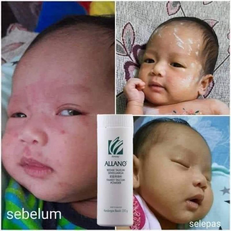 💥READY STOCK💥BEDAK TALKUM ALLANO ORIGINAL BY AMWAY | Shopee Malaysia