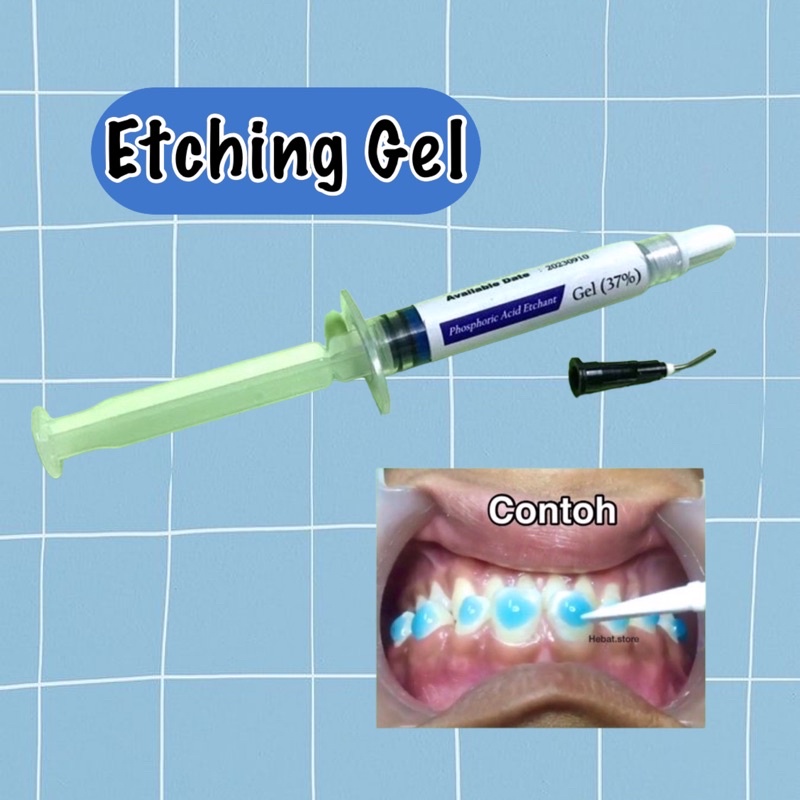 Dental Etching Gel / Whitening Gel / Etching Gel Biru Cuci Dental Orthodontic | Shopee Malaysia
