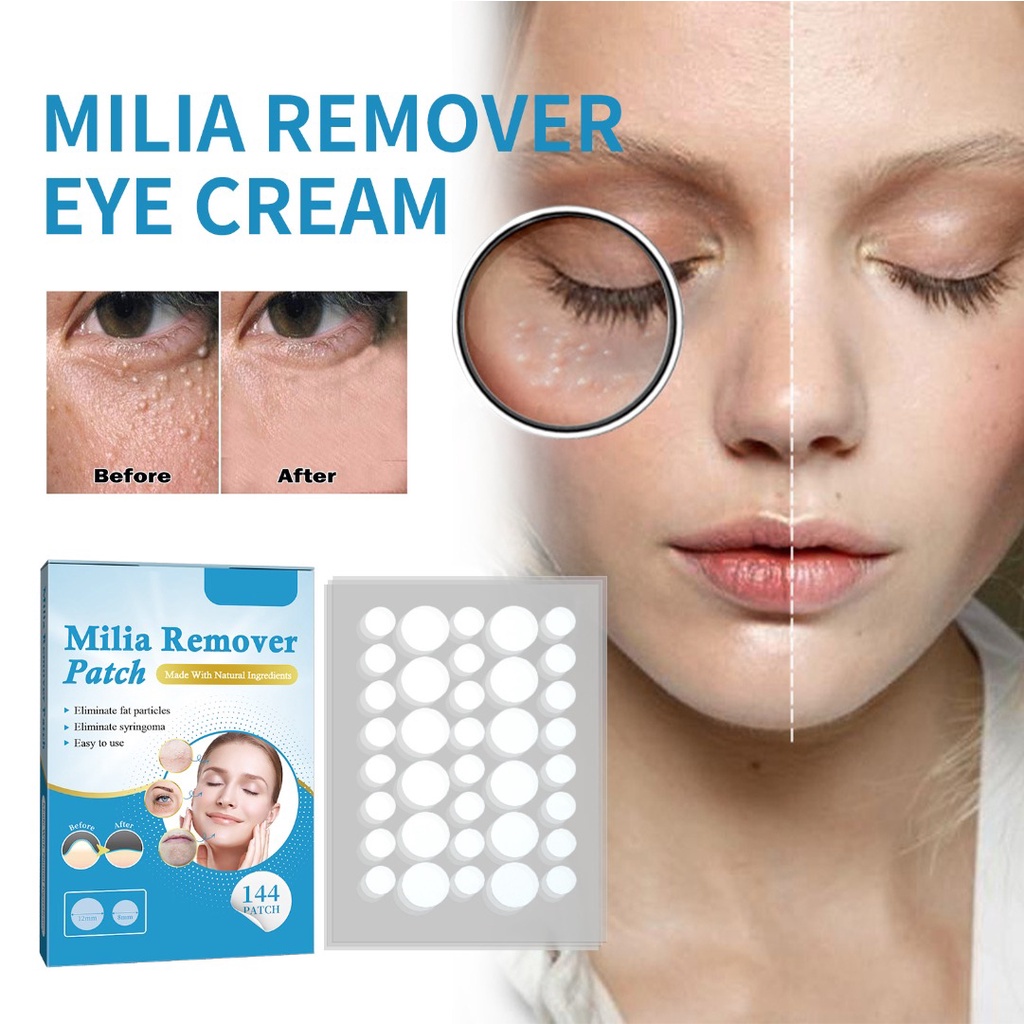 144pcs Milia Remover Patches for Milia Spot Treatment Soften skin ...