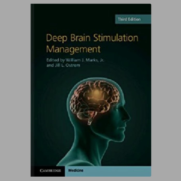 Deep Brain Simulation Management book | Shopee Malaysia