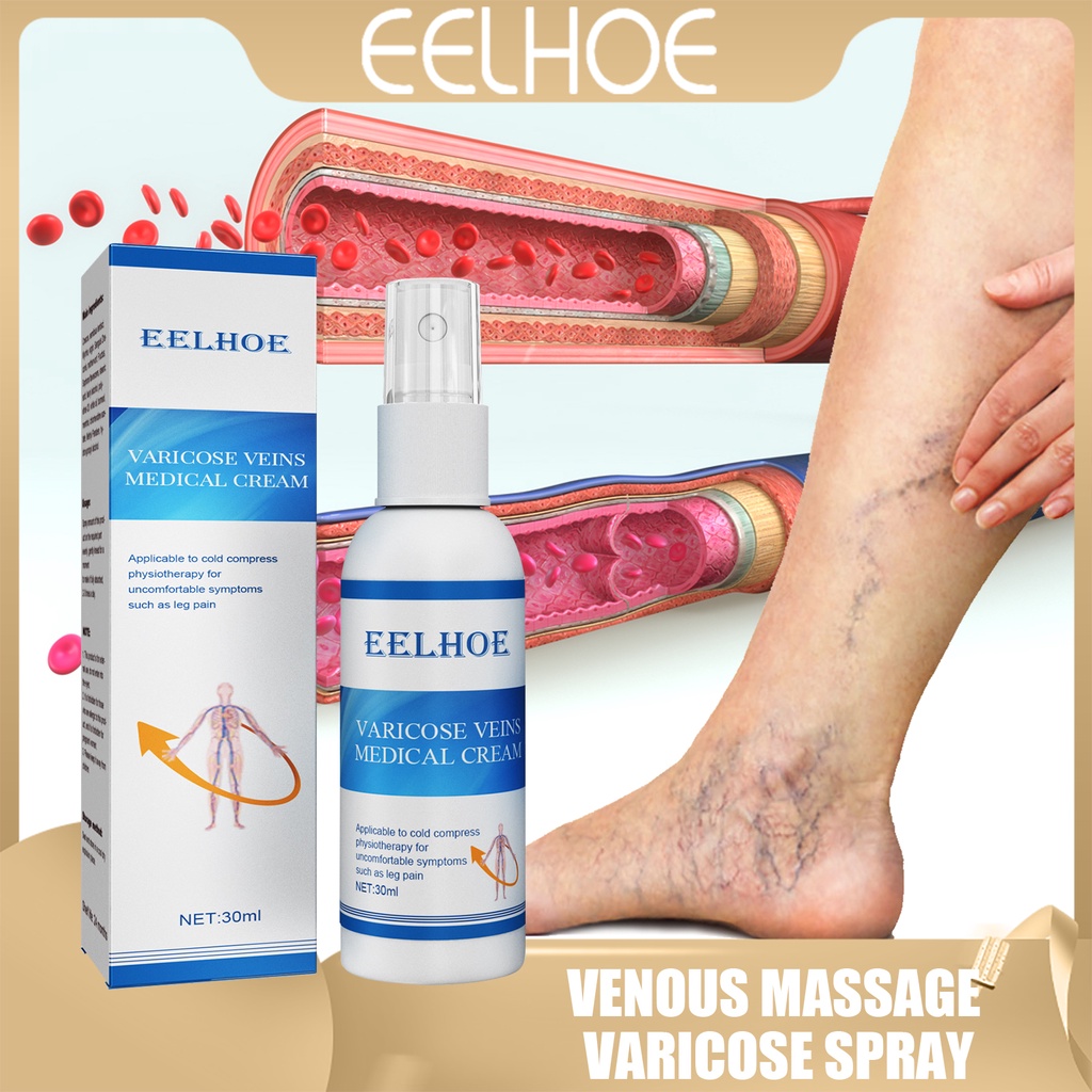 Eelhoe Venous Varicose Cream spray Pain Relieving spray Venous Massage ...