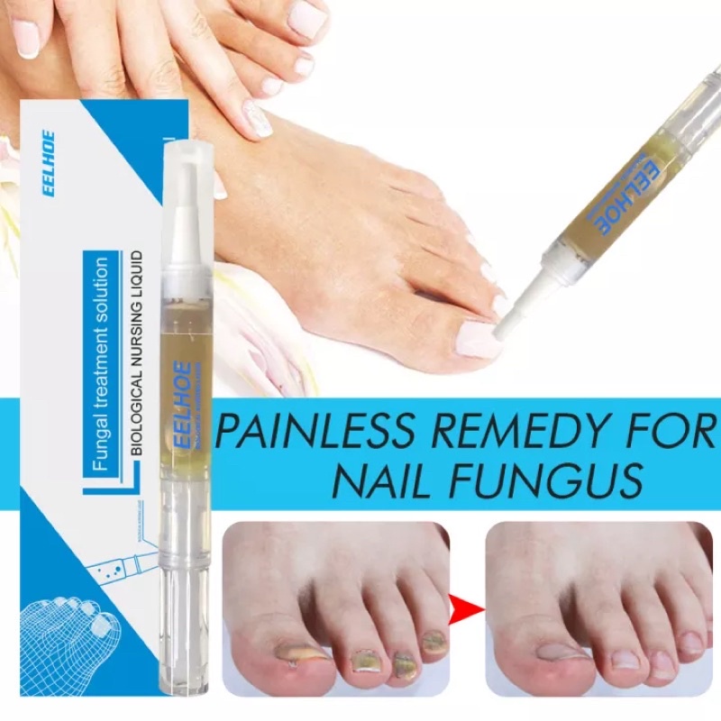 Ubat Kuku Rosak Nail Serum Toe Nail Care Kuku Cekam Rosak Nail Fungus ...