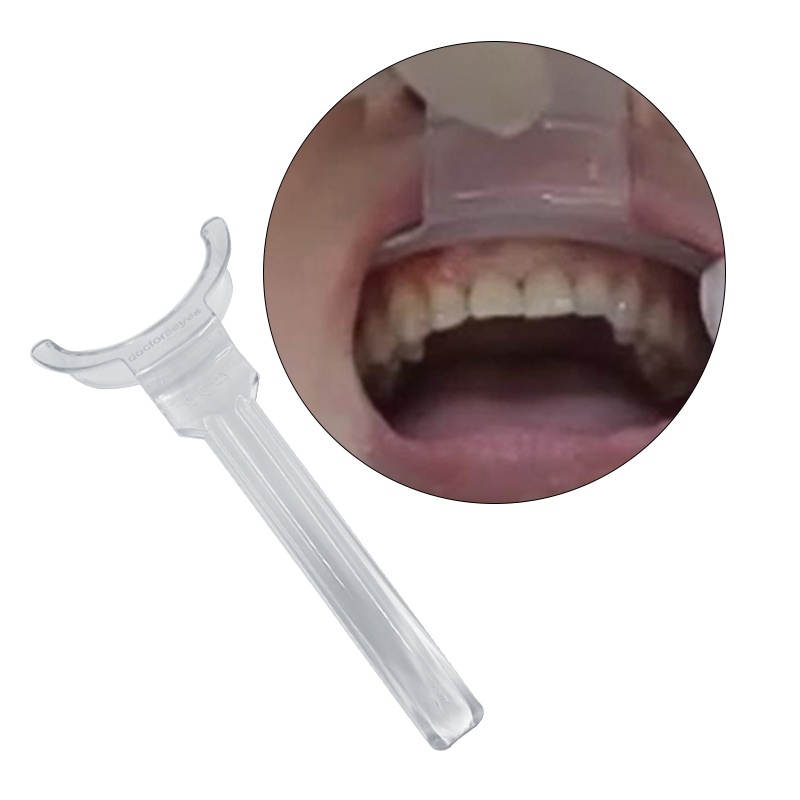Deluxe Upper and Lower Lip Retractor Intraoral Cheek Mouth Opener ...
