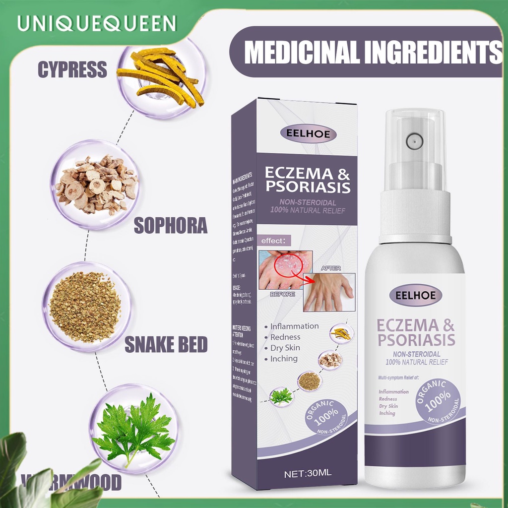 Eelhoe Tinea Pedis Spray Eczema Ointment Scalp Psoriasis Hand Tinea ...