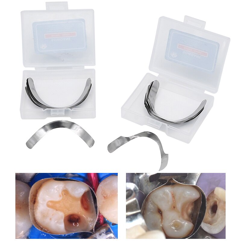20 Pcs Dental Tofflemire Matrix Bands for Deep Margin Elevation ...
