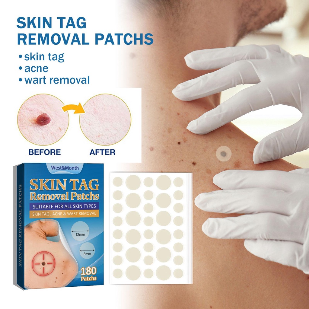 Mole Wart Remover Skin Tag Remover Patches Freckle Melanin Spots Acne ...