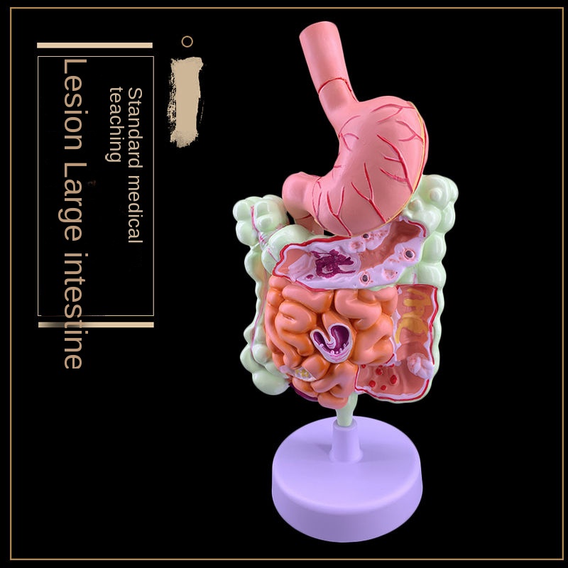 Human Stomach Gastrointestinal / Digestive System / Intestine Gastro ...