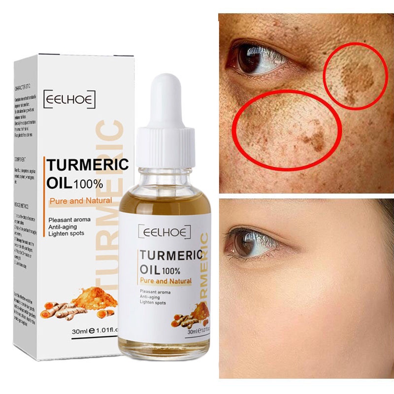 EELHOE Turmeric Freckle Whitening Serum Curcumin Oil Brighten Fade Dark ...
