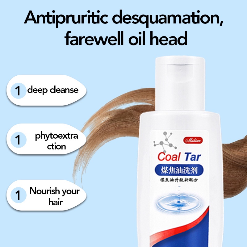 110ML Coal Tar Lotion Anti-dandruff Anti-itch Antibacterial Liquid ...
