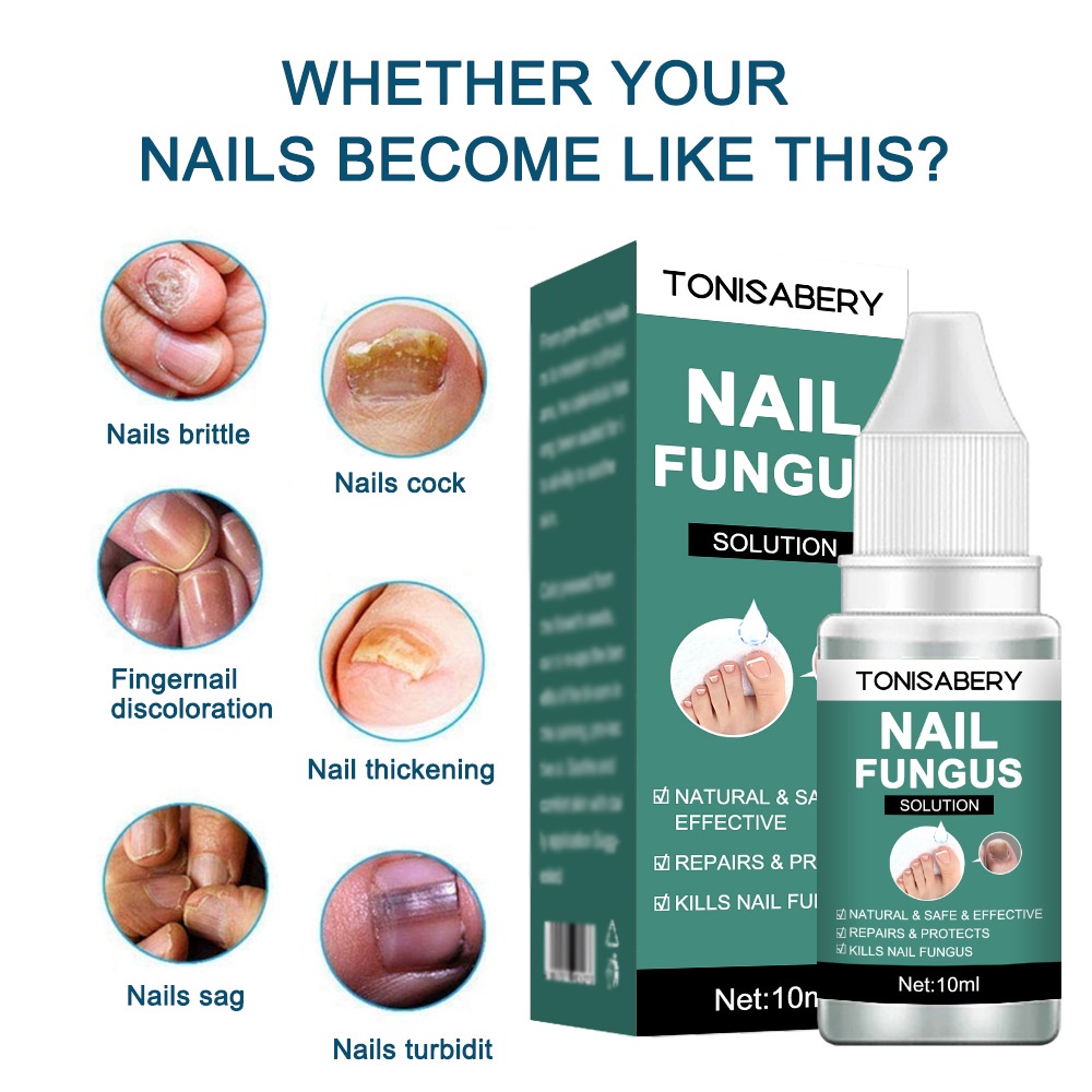 Nail Fungal Treatment Feet Care Essence Anti Infection Paronychia ...