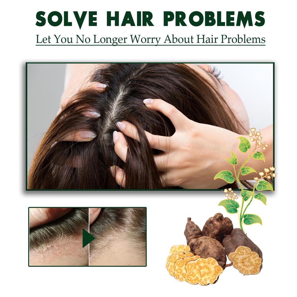 Refreshing Maintenance Scalp Shampoo Tinea Capitis Shampoo Anti-mite ...
