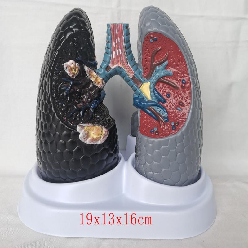 （Ready stock）Life Size Human Lung Model Anatomical Respiratory System ...