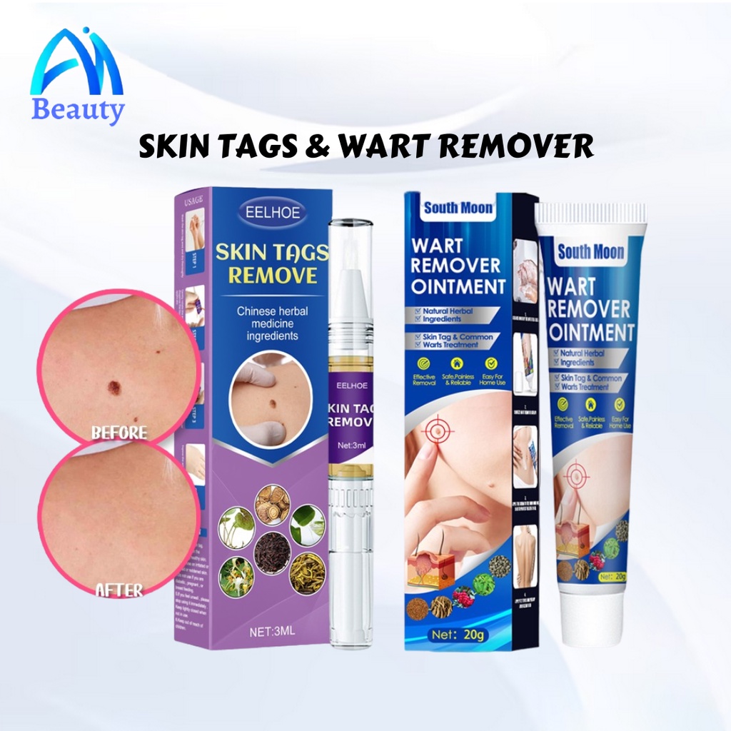 Wart Removal Body Warts Treatment Cream Skin Tag Remover Blemish ...