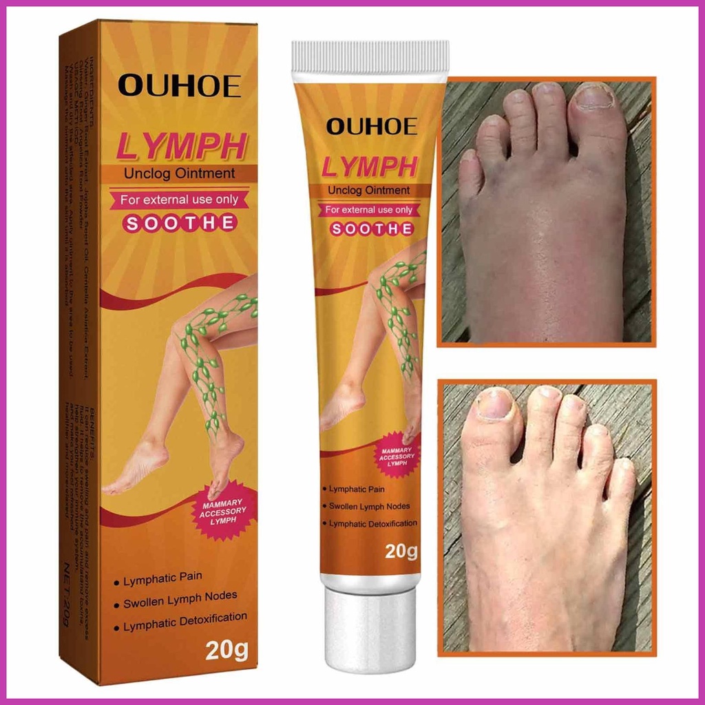Anti Swelling Detoxing Ointment 20g Lymph Care Ointment Anti Cellulite ...