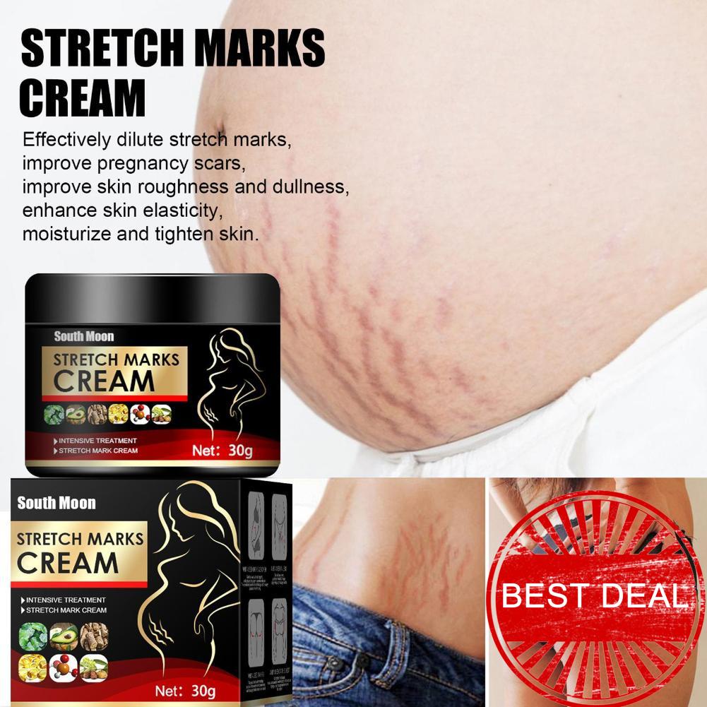 30g Stretch Marks Repair Cream Lightens Postpartum Marks Peel Growth ...
