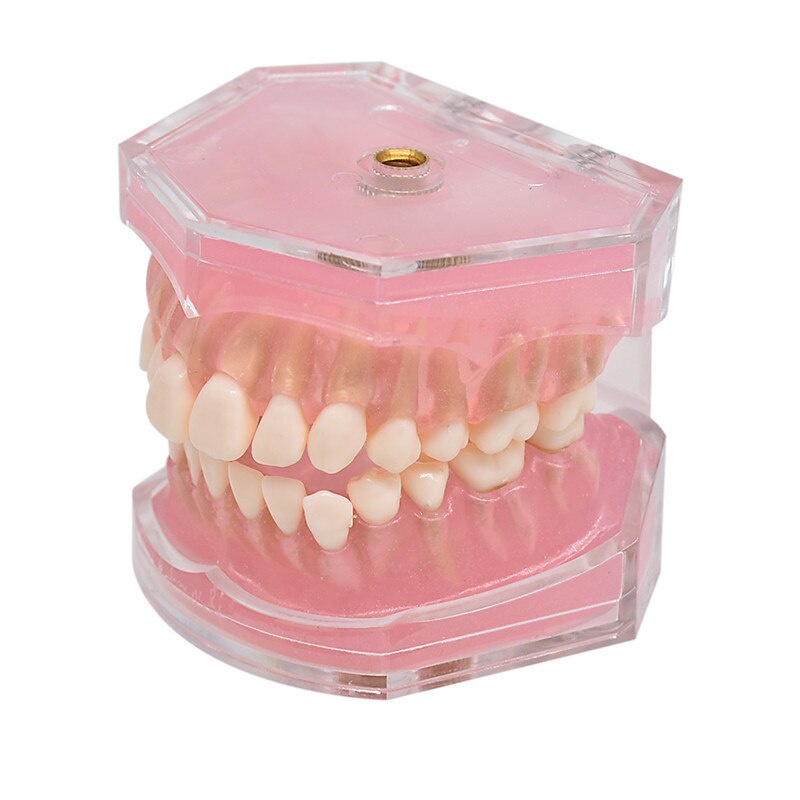 Dental Model Removable Teeth Soft Gum Teeth Model TYPODONT Tooth Model ...
