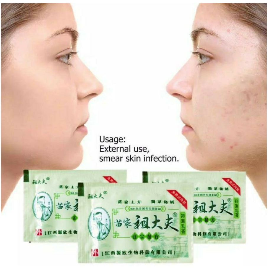 Zudaifu Sachet Medicine Skin Itching Cream Zudaifu Sachet Ointment Skin ...
