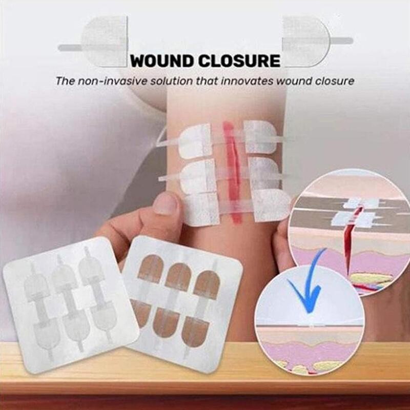 Zipper Band-aid Painless Wound Closure Device Without Needles Suture ...