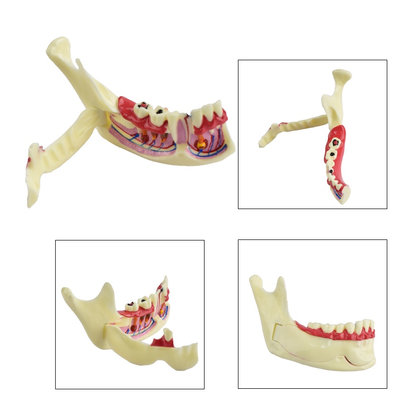 Dental Endodontic Treatment Model Mandible Tissue Anatomical Model ...