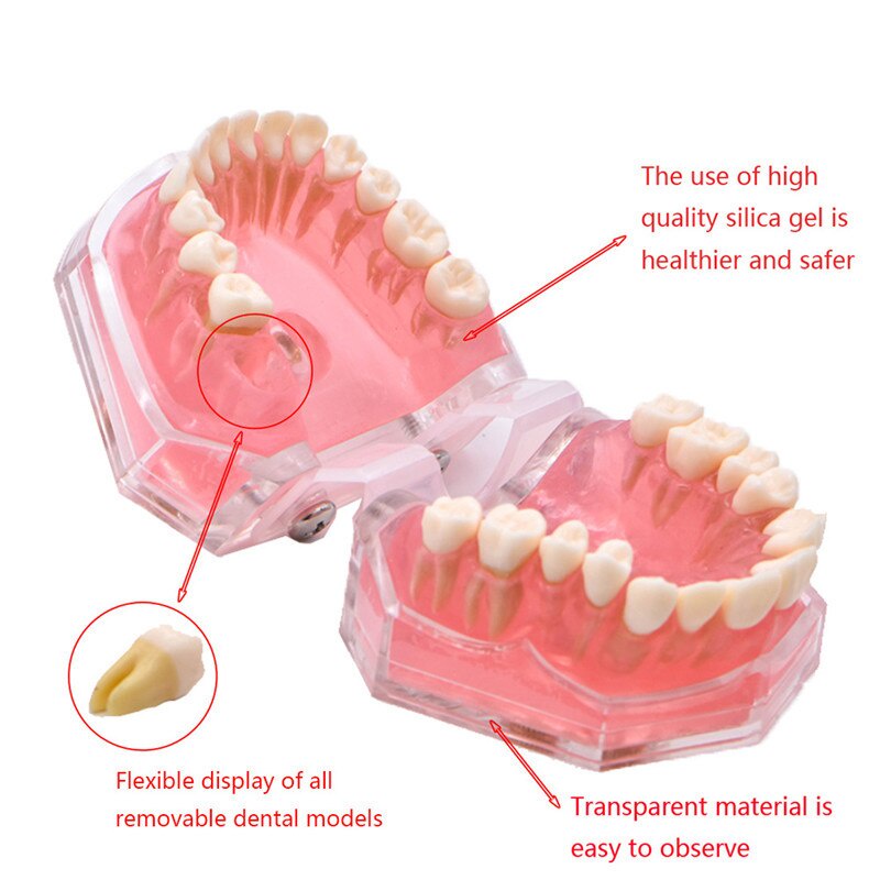 Dental Model Removable Teeth Soft Gum Teeth Model TYPODONT Tooth Model ...