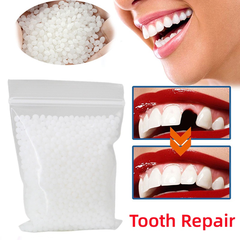 Resin Tooth Repair Glue Shapeable Teeth Gaps Filling Solid Glue ...