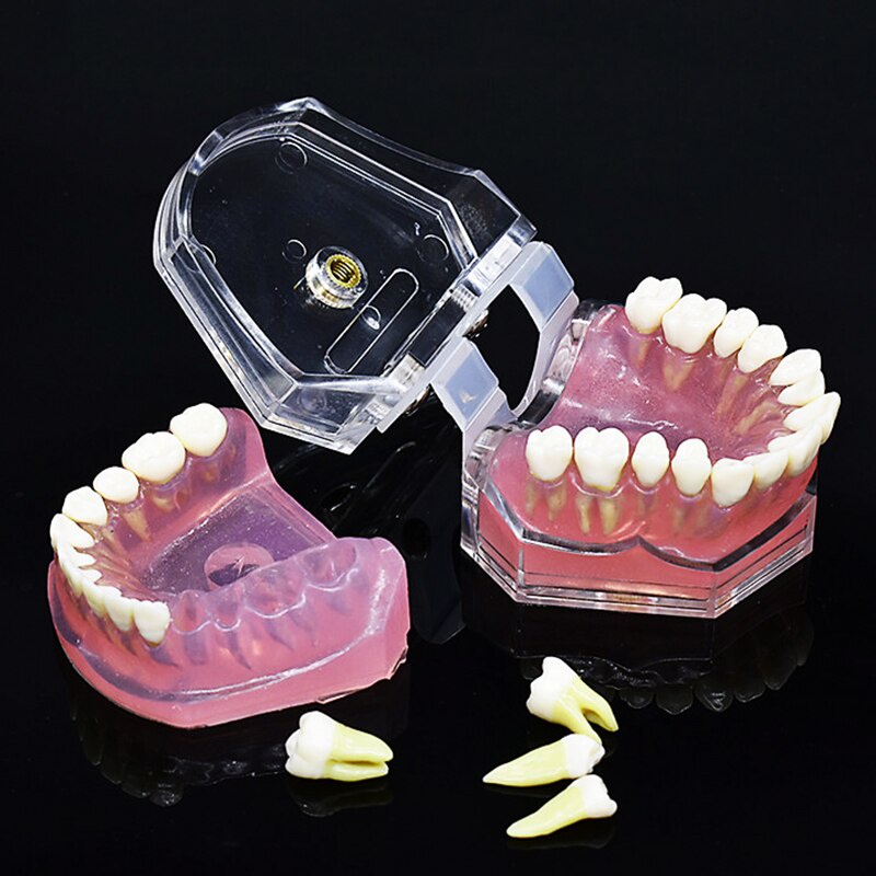 Dental Model Removable Teeth Soft Gum Teeth Model TYPODONT Tooth Model ...