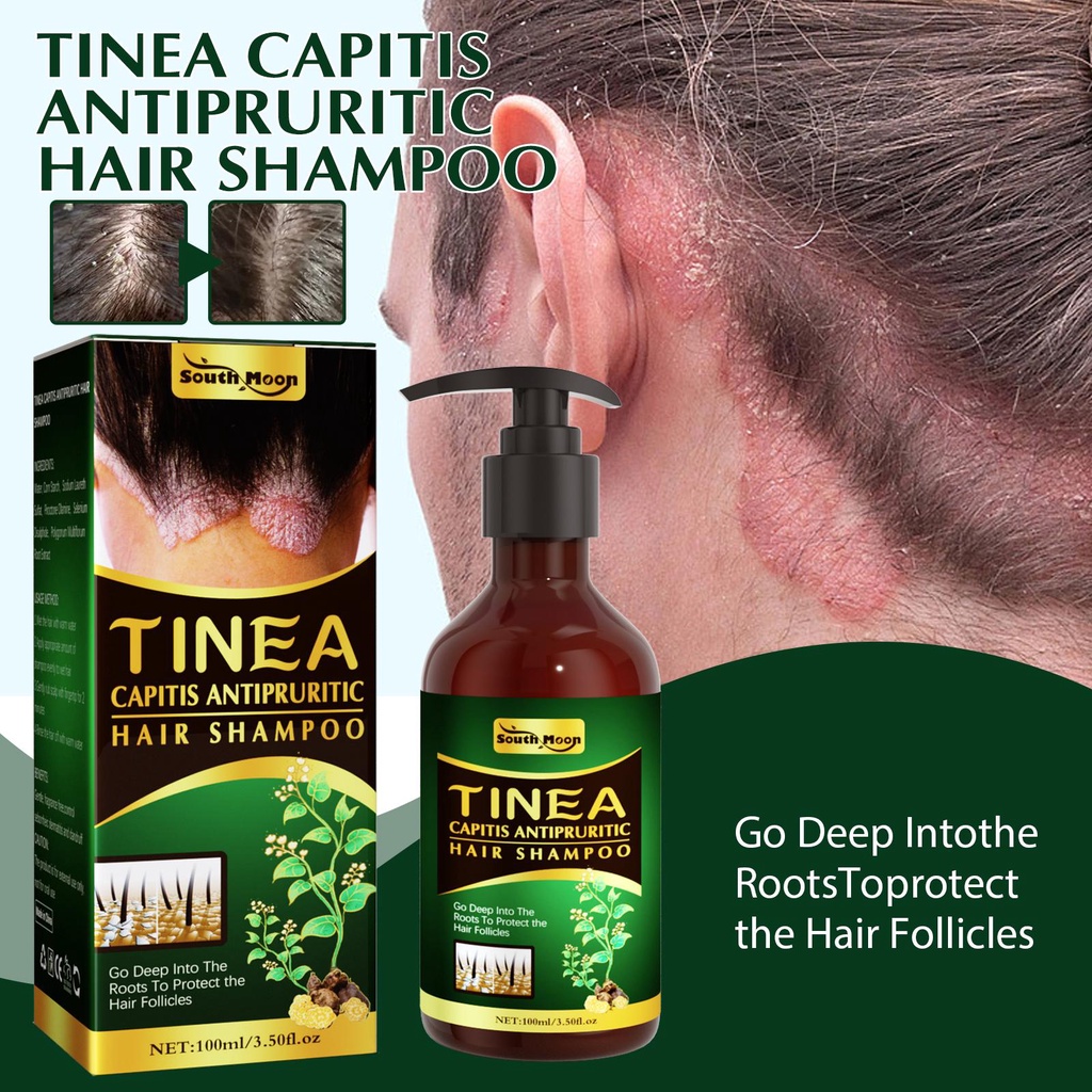 Refreshing Maintenance Scalp Shampoo Tinea Capitis Shampoo Anti-mite ...