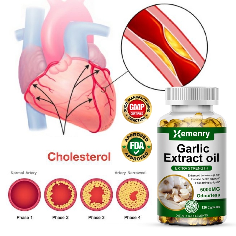 XEMENRY Organic Garlic Capsules for Lowering Cholesterol to Promote ...