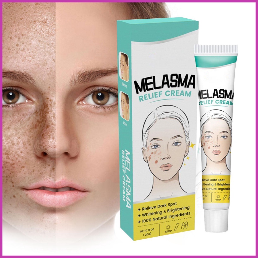 Black Spot Cream 20g Body Moisturizing Cream Sun Spot Removal Face ...