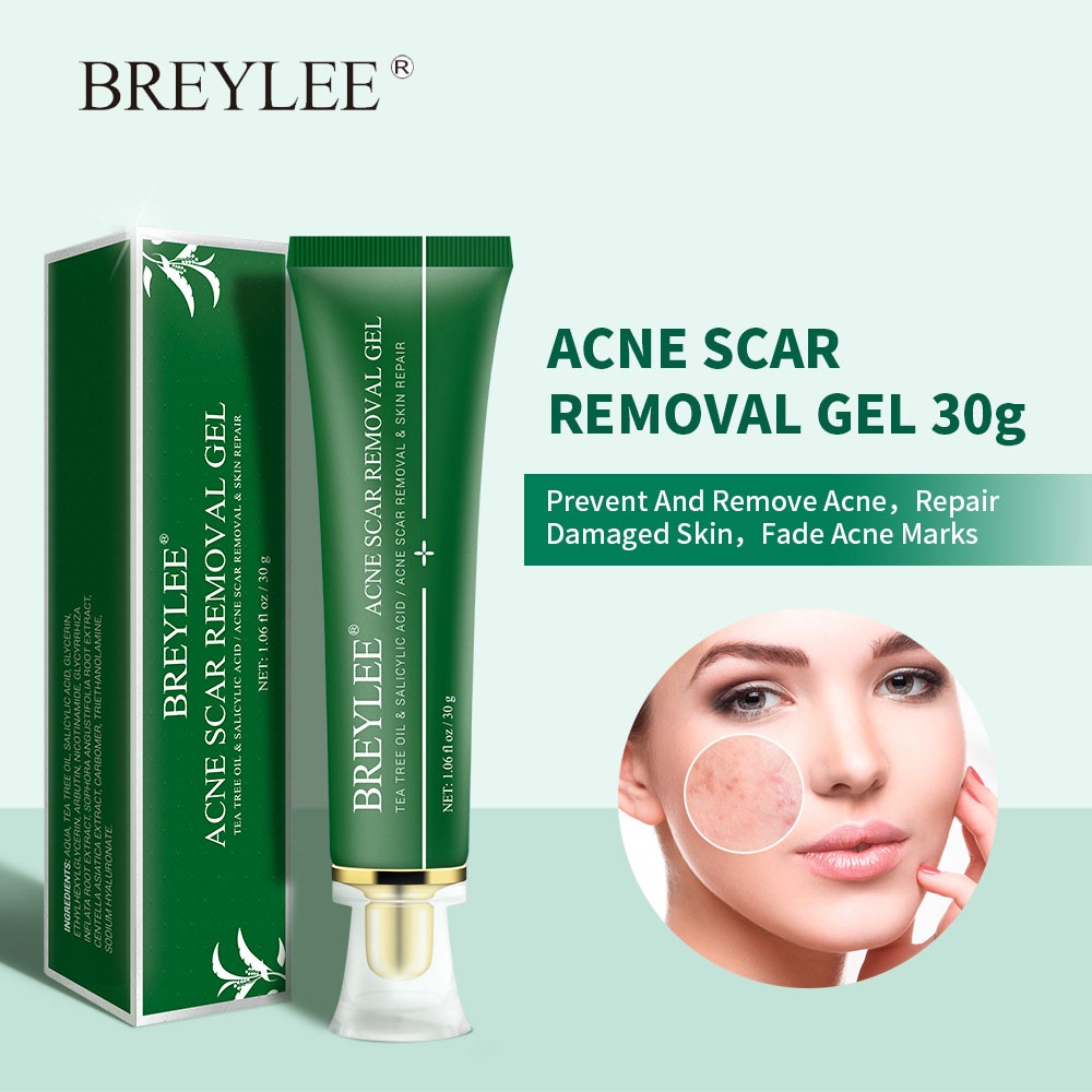 Breylee Acne Scars Removal Gel repair the skin Eliminate Acne Without Leaving Marks Skincare 30g ...