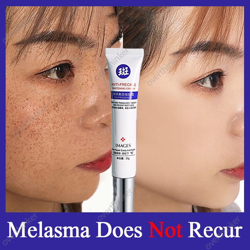 Original IMAGES Age Spots Remover Melasma and Pekas Remover Whitening ...