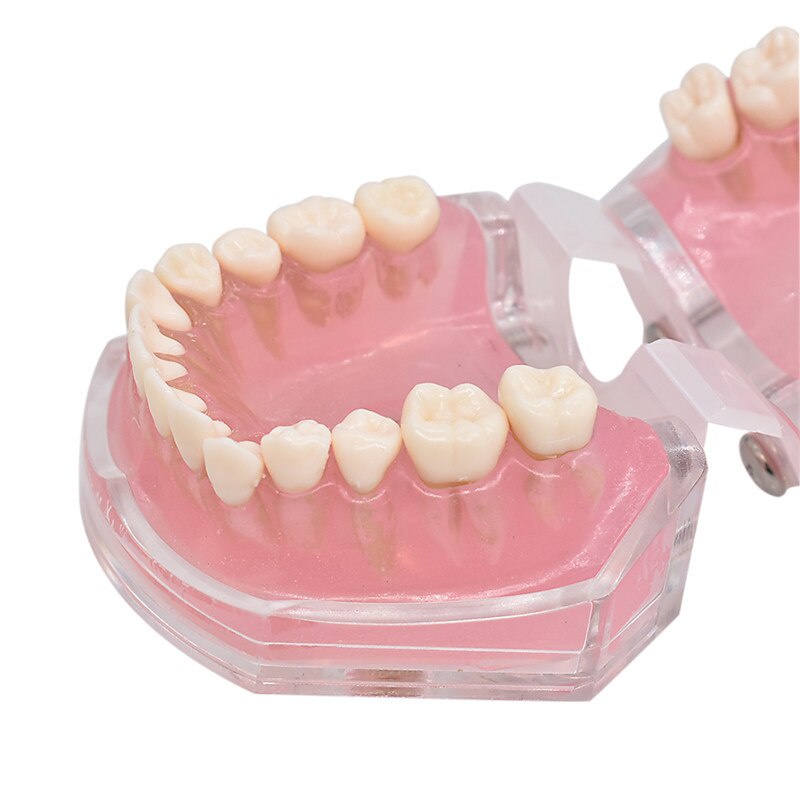 Dental Model Removable Teeth Soft Gum Teeth Model TYPODONT Tooth Model ...