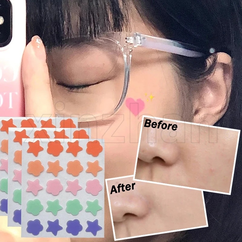 1 Sheet Waterproof Face Skin Care Sticker Mini Invisible Acne Removal ...