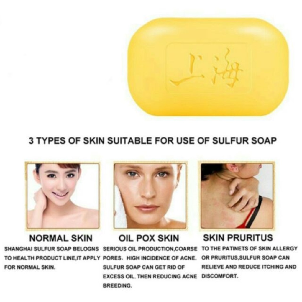 1pc Sulfur Soap Anti Acne Fungus Bath | Shopee Malaysia