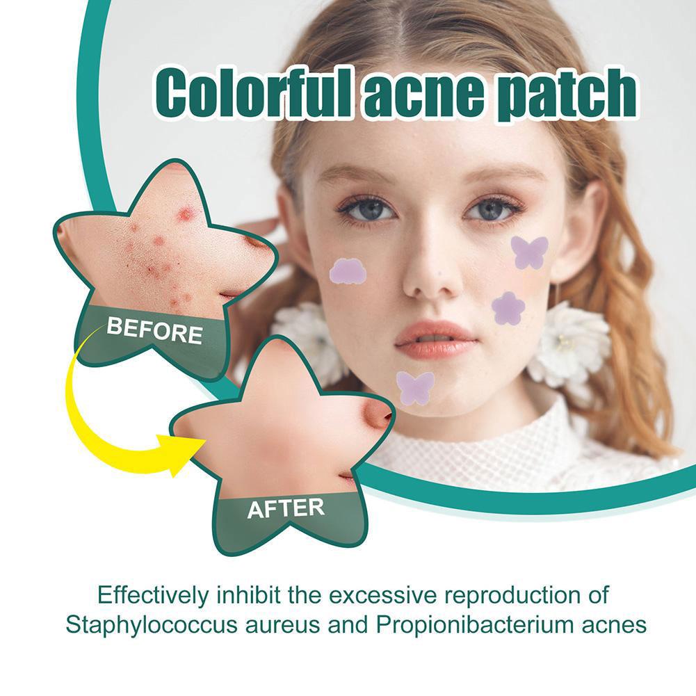Colorful Acne Stickers Star Cloud Butterfly Circle Flowers Shape ...