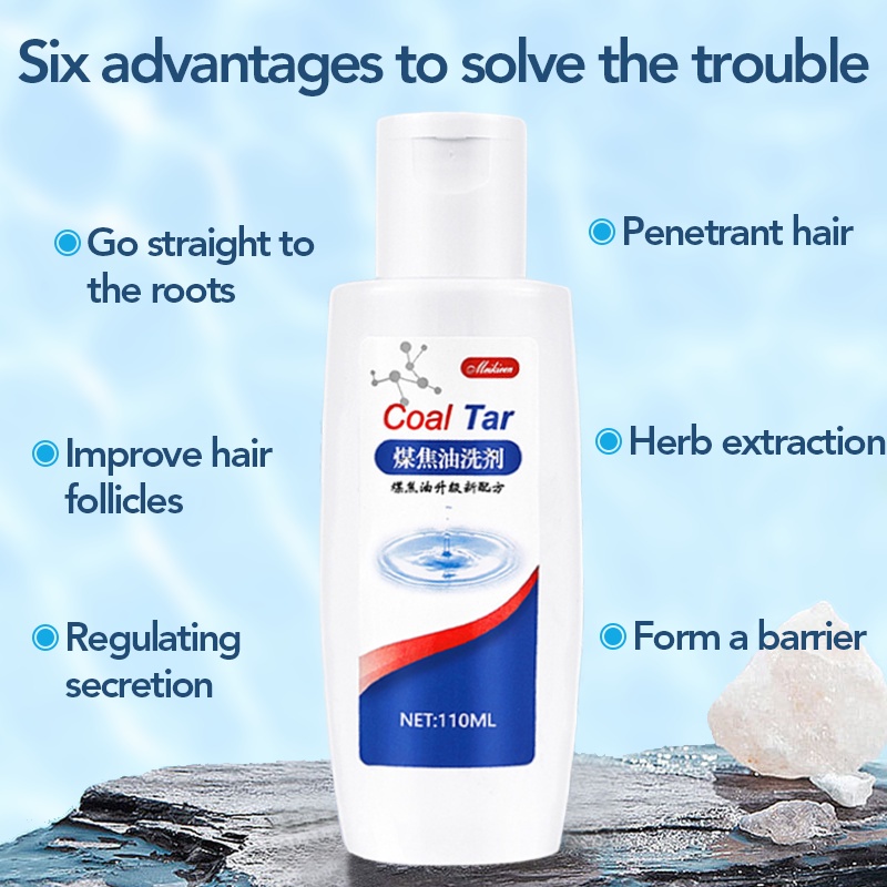 110ML Coal Tar Lotion Anti-dandruff Anti-itch Antibacterial Liquid ...