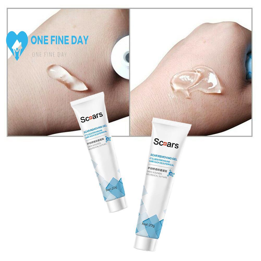 20g Scar Cream Scar Removal Cream Peklat Remover Acne To Marks Cream ...