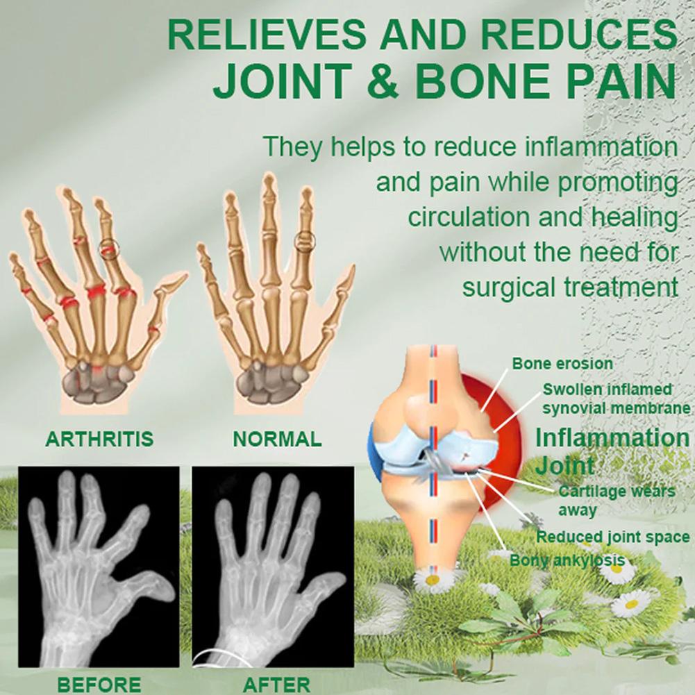 BEEVANA Bee Venom Joint And Bone Therapy Cream Relieve Arthritis Pain ...