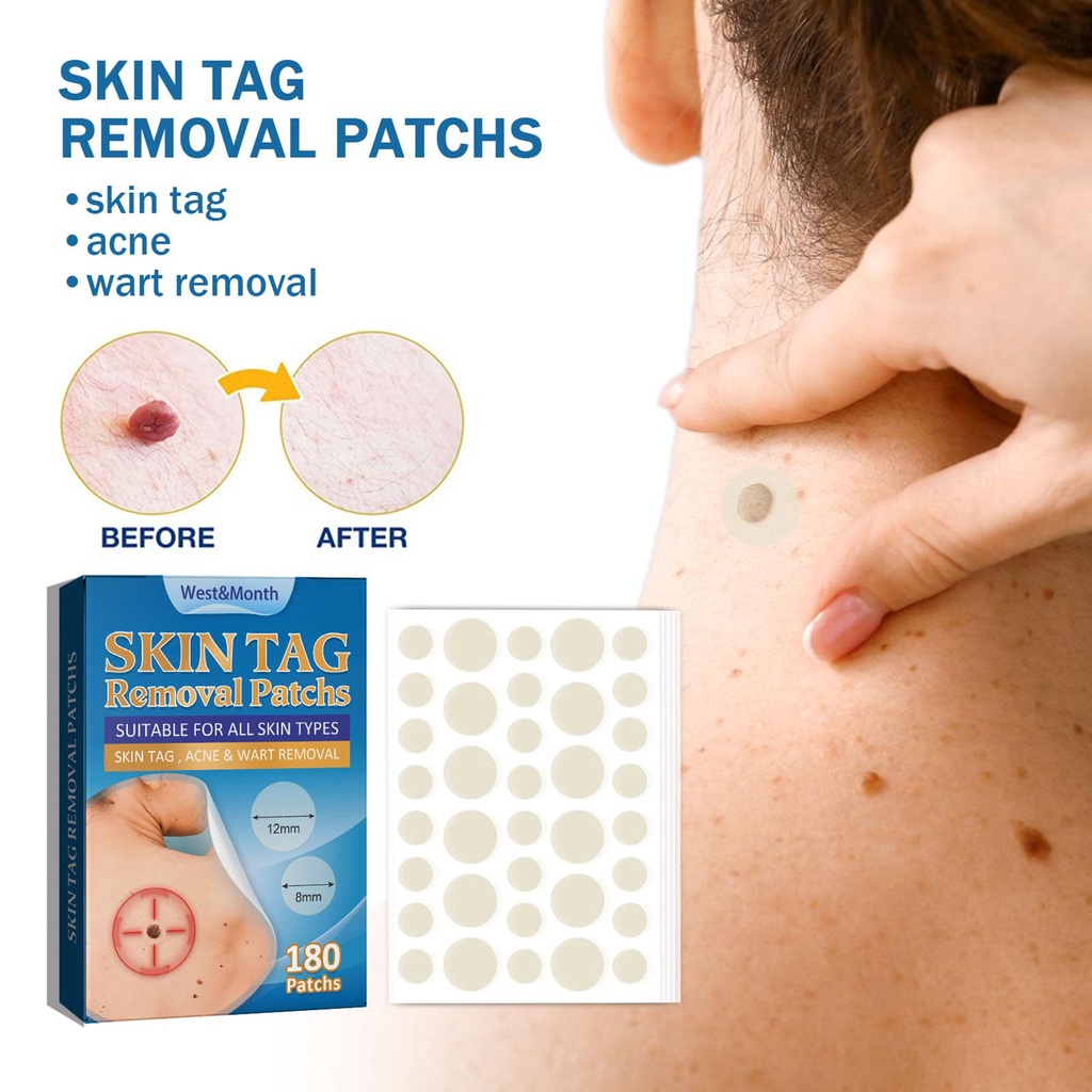 180pcs/box Multifunctional Wart Acne Removal Sticker Skin Tag Remover ...