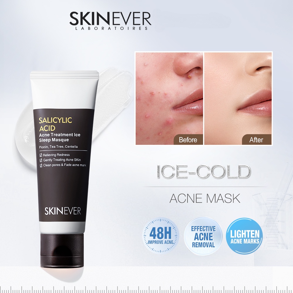 SKINEVER Salicylic Acid Acne Treatment Ice Sleep Masque Anti Acne Anti ...